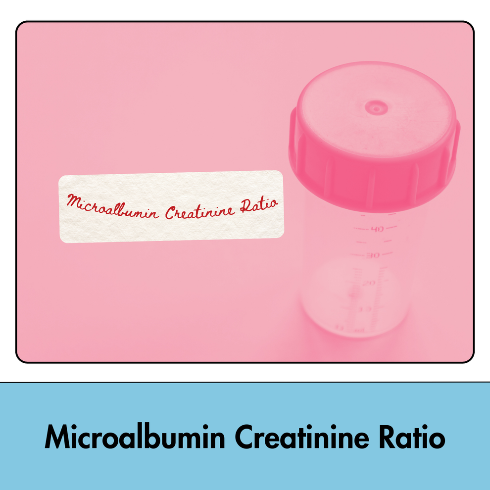Microalbumin Creatinine Ratio, Urine test in Kolkata | AllHealth